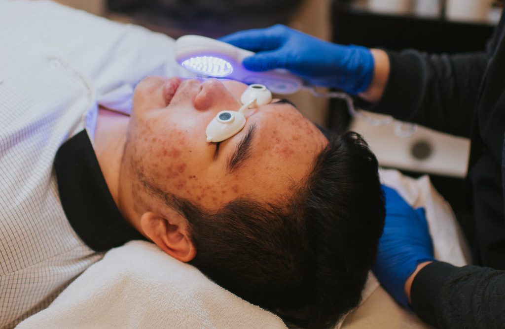 Acne Treatments – Renewal Skin Spa